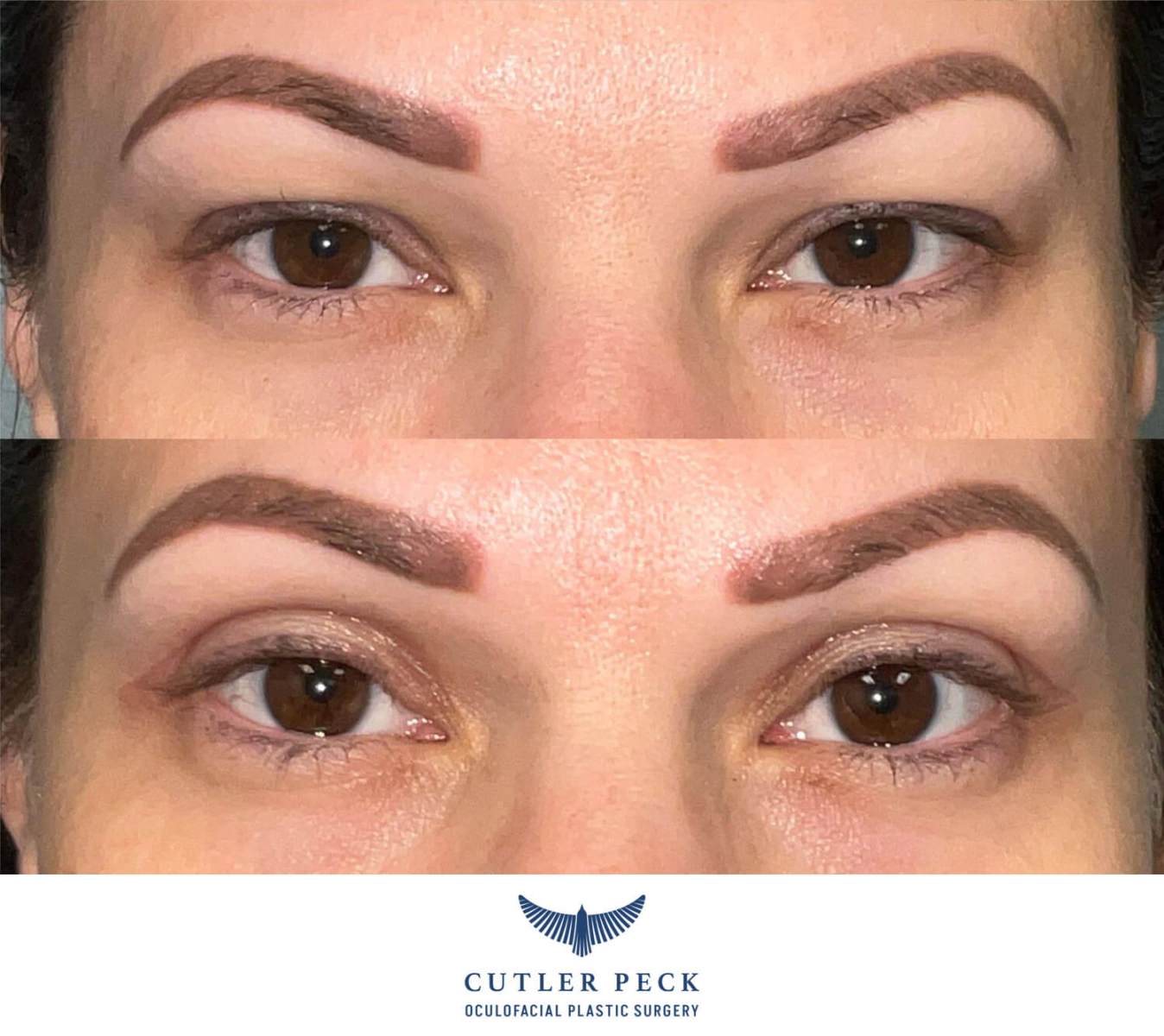 Before and After Photo Gallery | Dr. Cutler Peck
