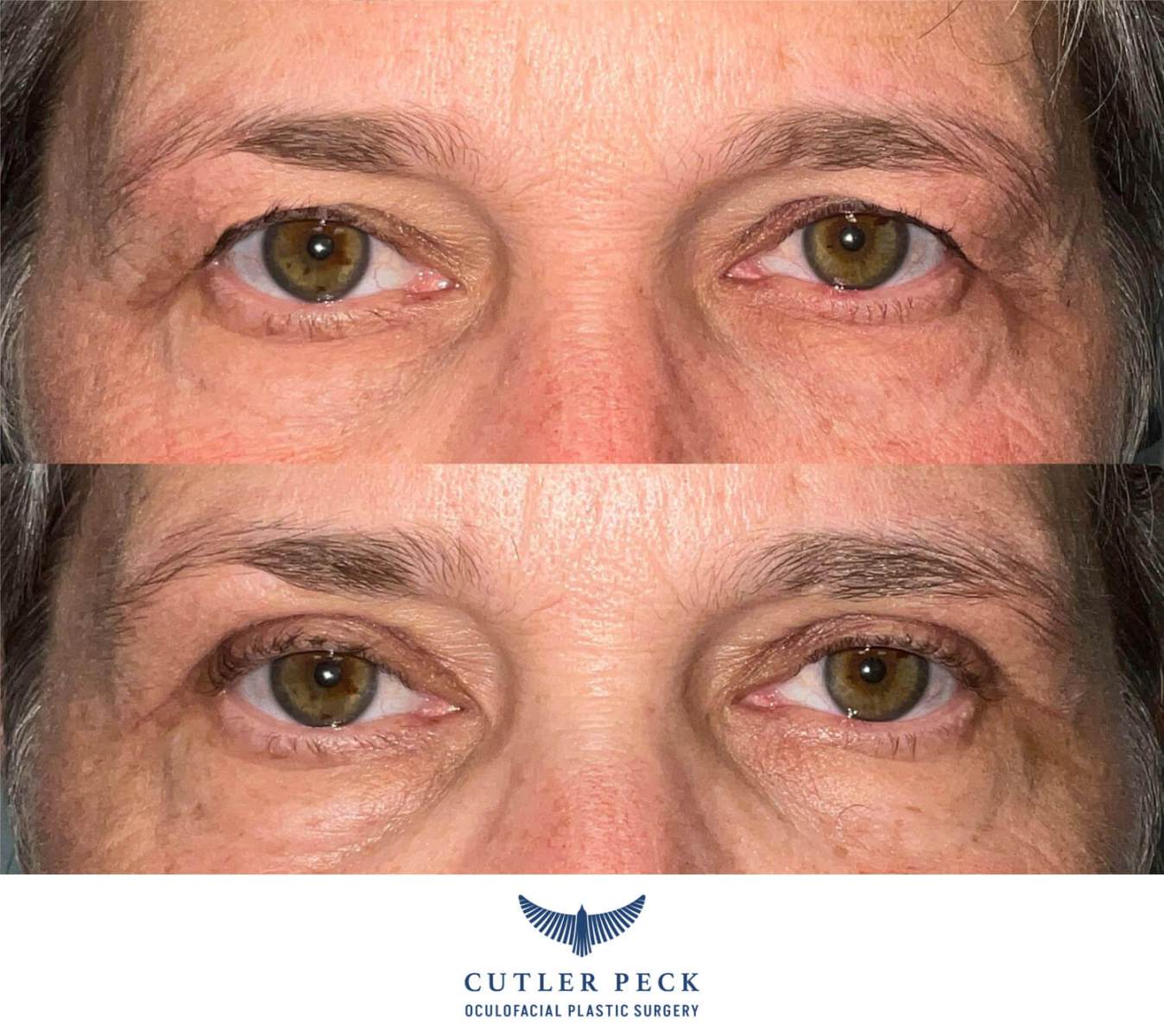 Before and After Photo Gallery | Dr. Cutler Peck