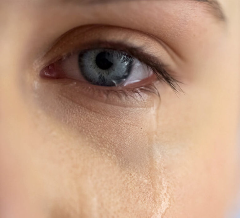 Excessive Tearing Treatment | Dr. Cutler Peck